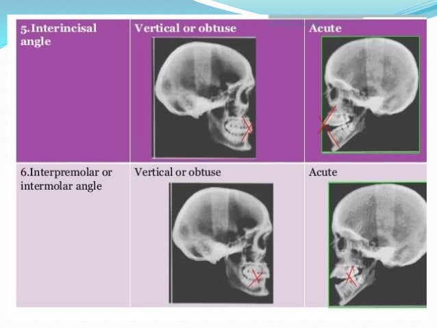 High angle -low angle cases