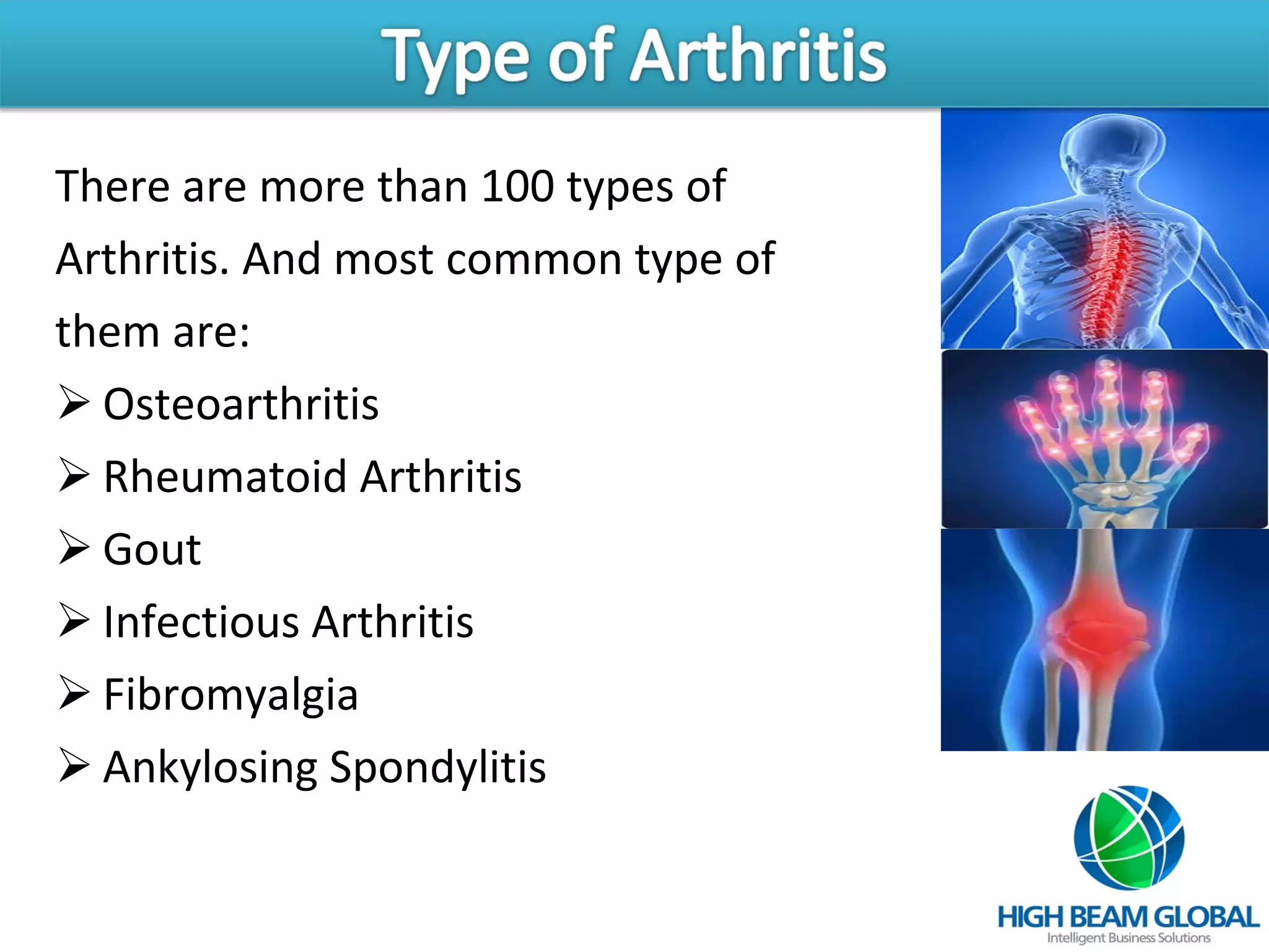 Arthritis | PPT