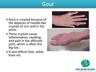 Arthritis | PPT