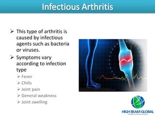 Arthritis | PPT