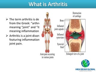 Arthritis | PPT