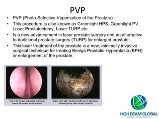 Prostate Cancer | PPT