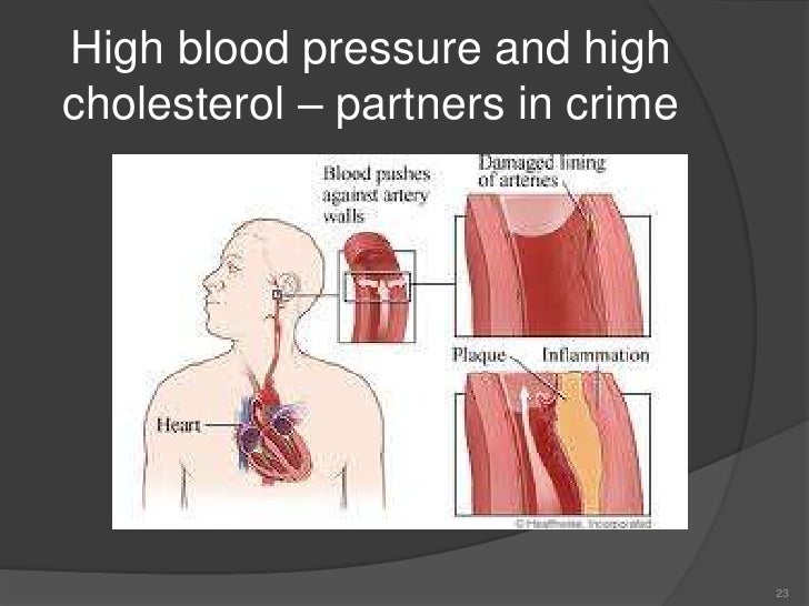 High Blood Pressure And High Cholesterol February Conference High Blood Pressure And High Cholesterol February Conference