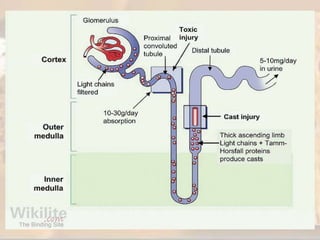 High cut off dialysis and multiple myeloma | PPSX