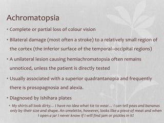 Higher visual dysfunction | PPTX