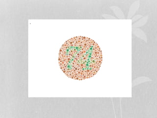 Higher visual dysfunction | PPTX