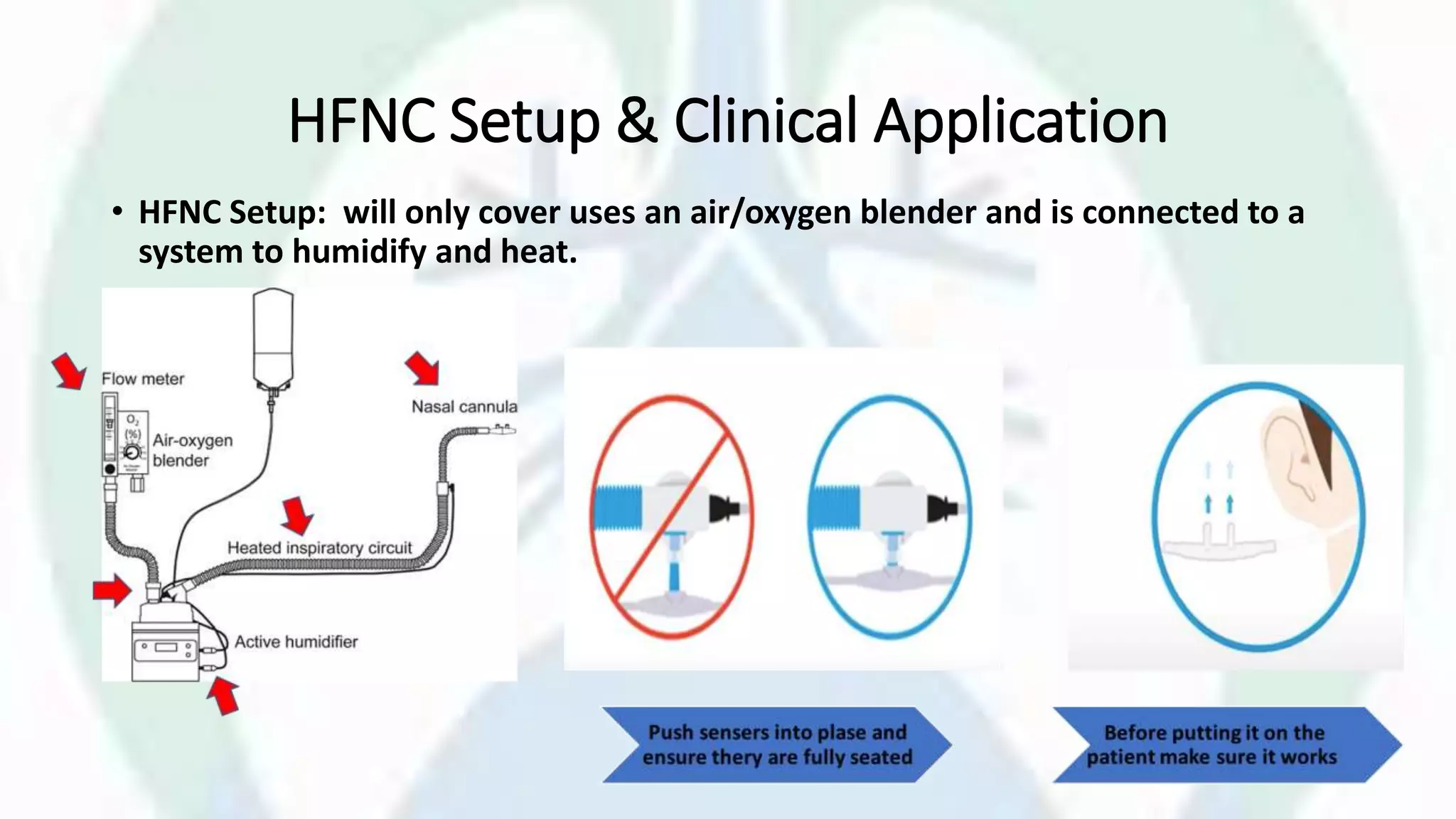 High flow nasal cannula (hfnc) linkden | PPTX