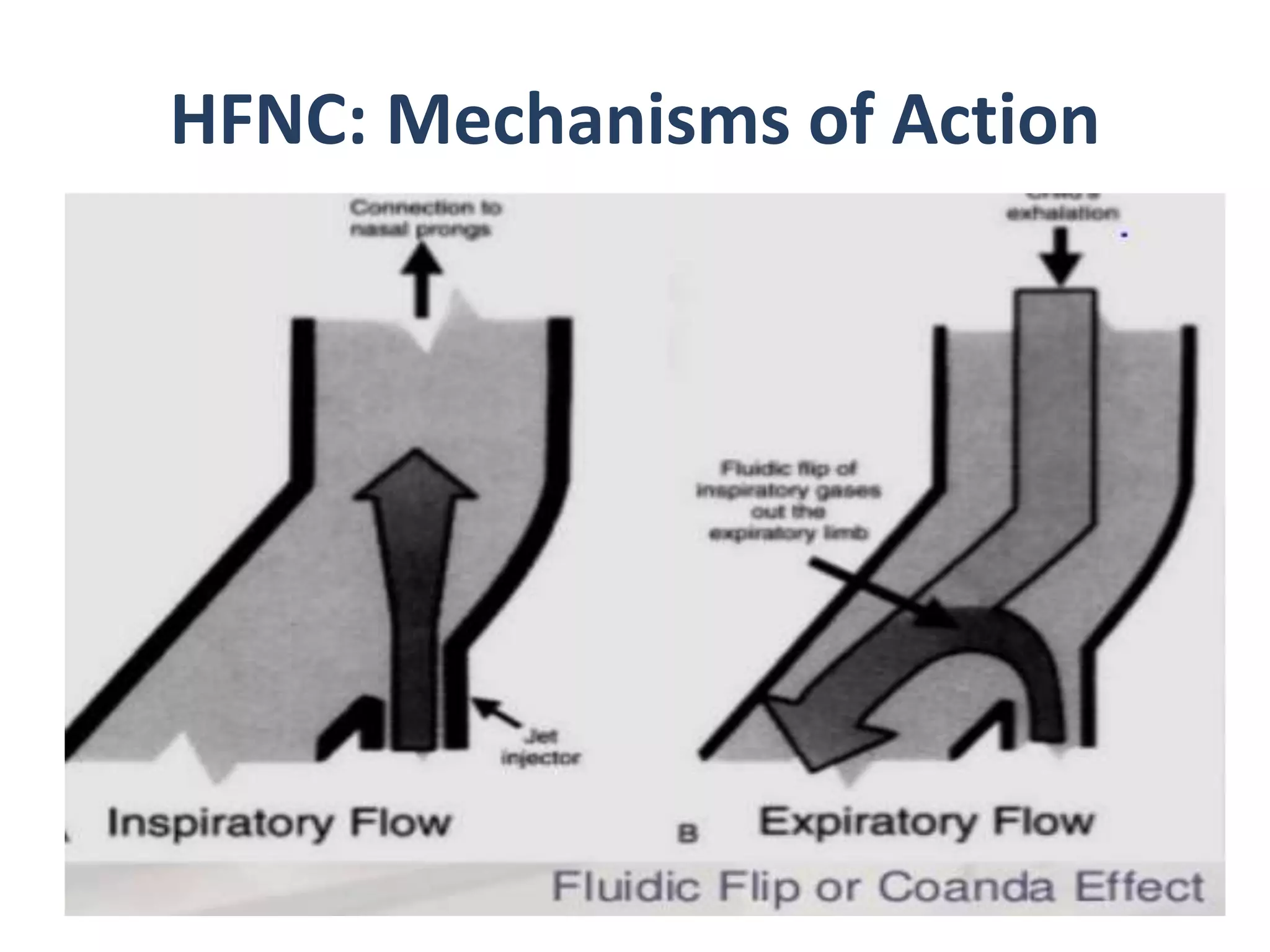 High flow nasal cannula in neonataes | PPTX