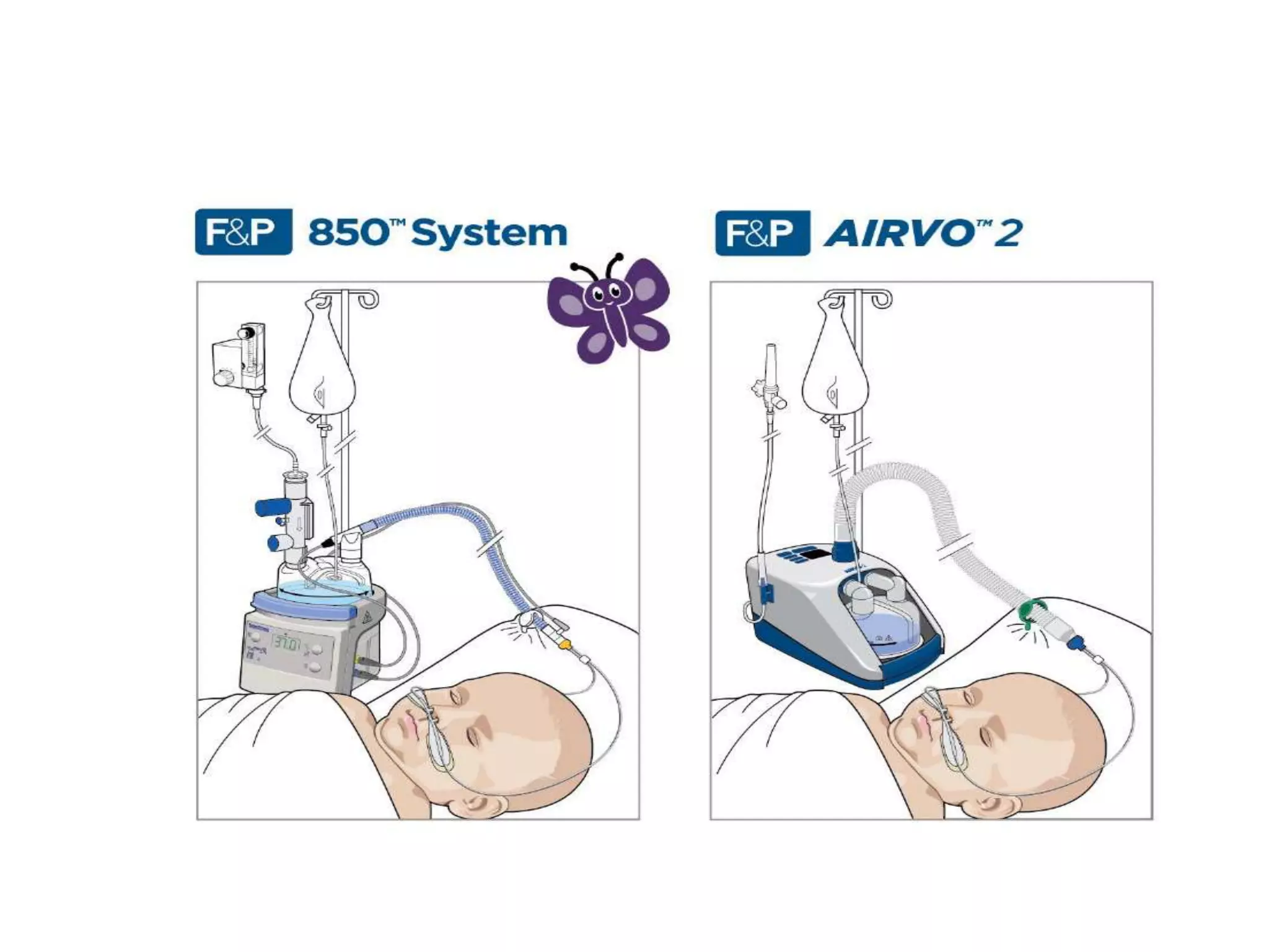 High flow nasal cannula in neonataes | PPTX