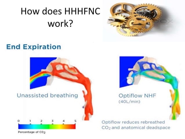 High flow nasal cannula in neonataes | PPTX | Lung and Respiratory ...
