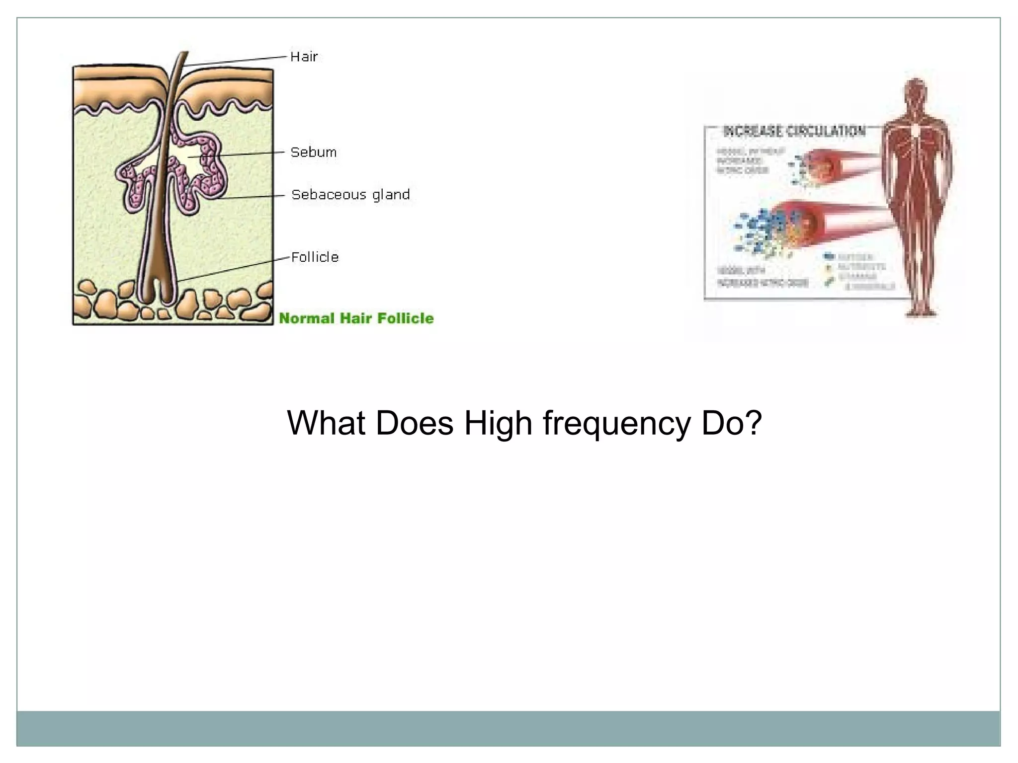 High frequency | PPT