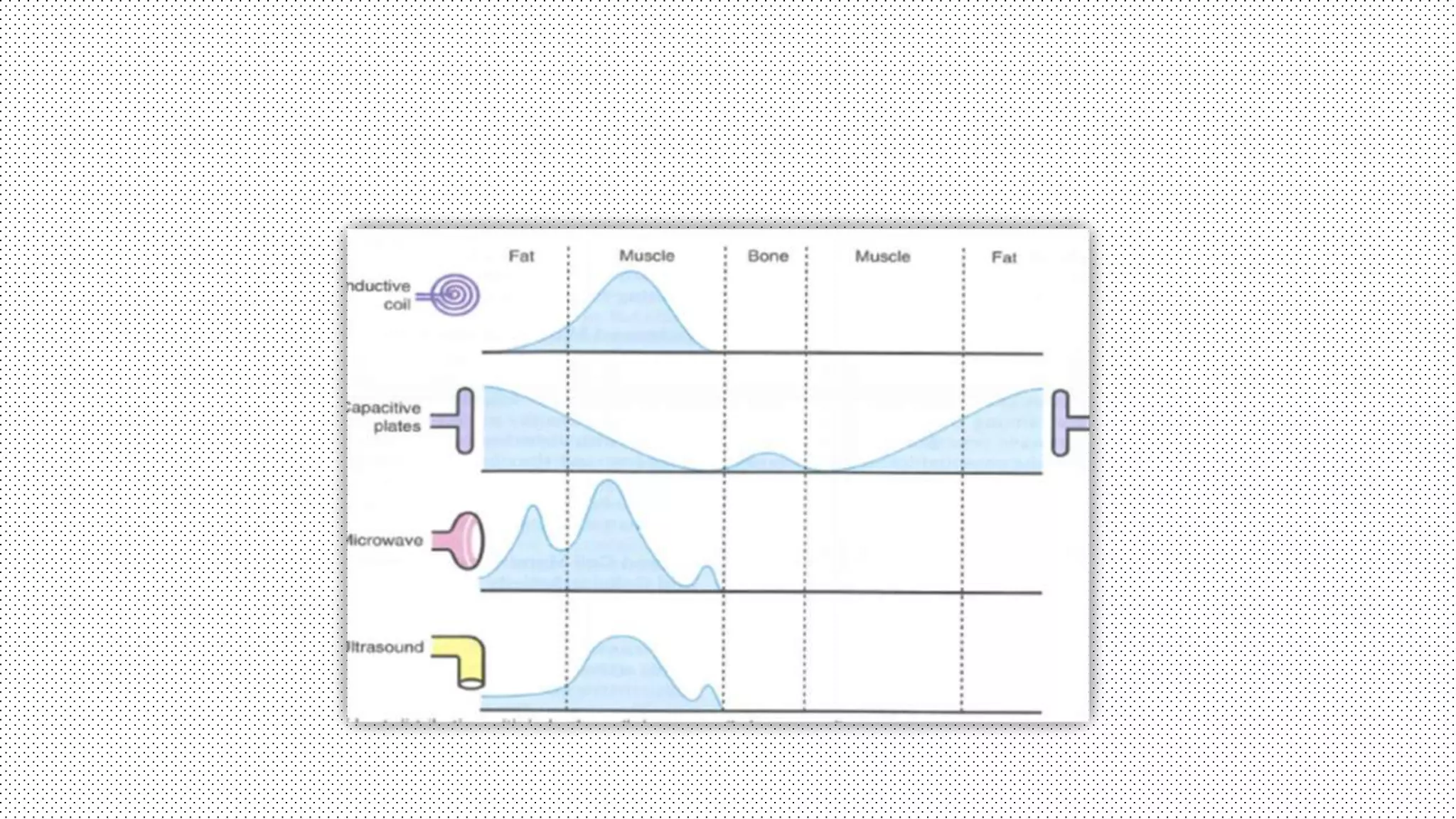 High Frequency Current (SWD & MWD).pptx