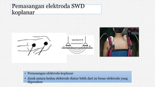 High Frequency Current (SWD & MWD).pptx