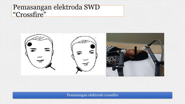 High Frequency Current (SWD & MWD).pptx