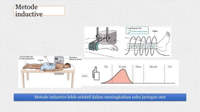 High Frequency Current (SWD & MWD).pptx