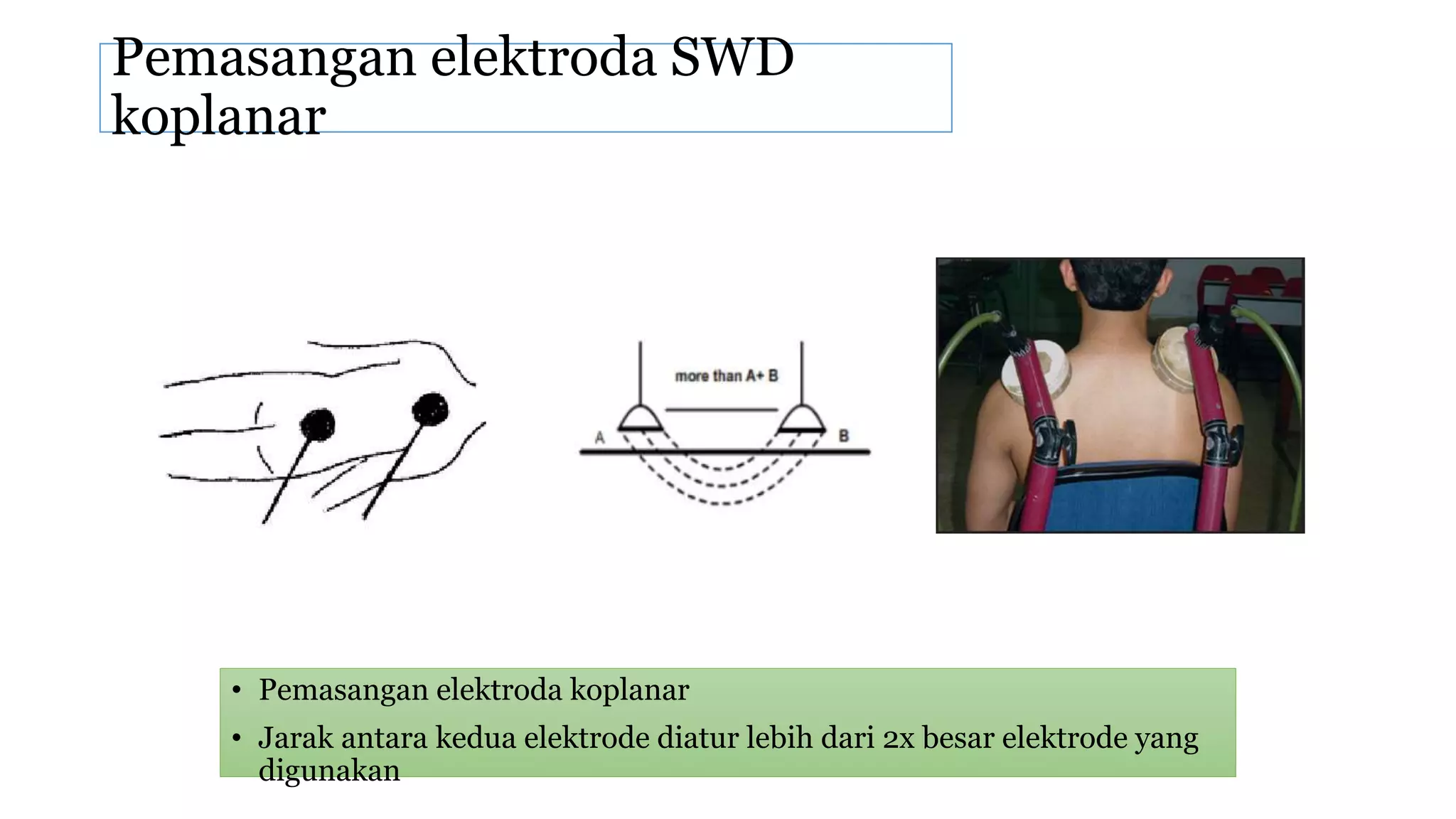 High Frequency Current (SWD & MWD).pptx