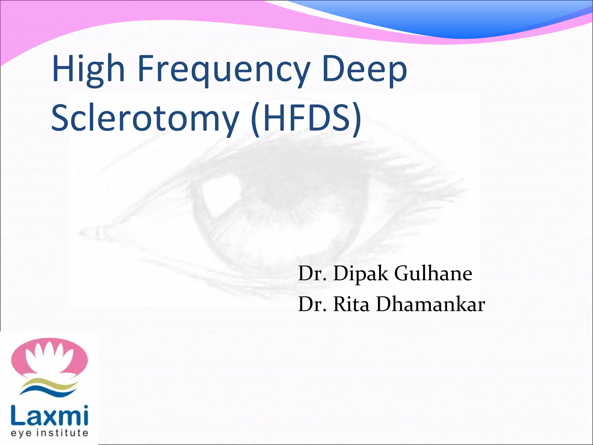 High Frequency Deep Sclerotomy (HFDS) | PPTX