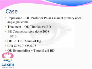 High Frequency Deep Sclerotomy (HFDS) | PPTX