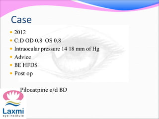 High Frequency Deep Sclerotomy (HFDS) | PPTX