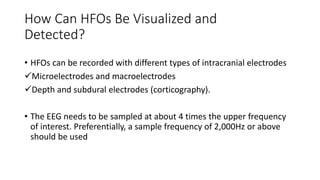 High frequency oscillations | PPT