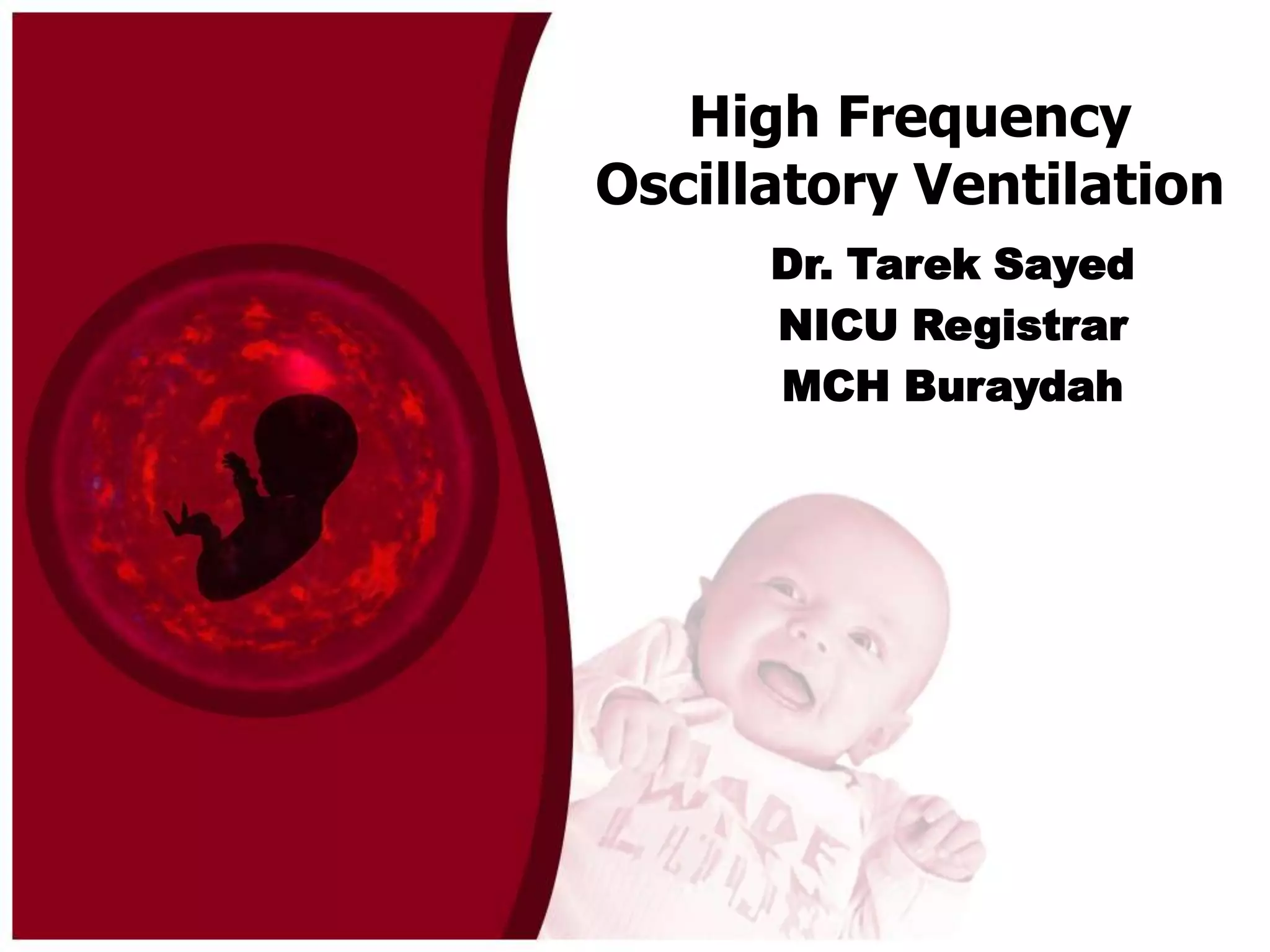 High frequency oscillatory ventilation | PPTX