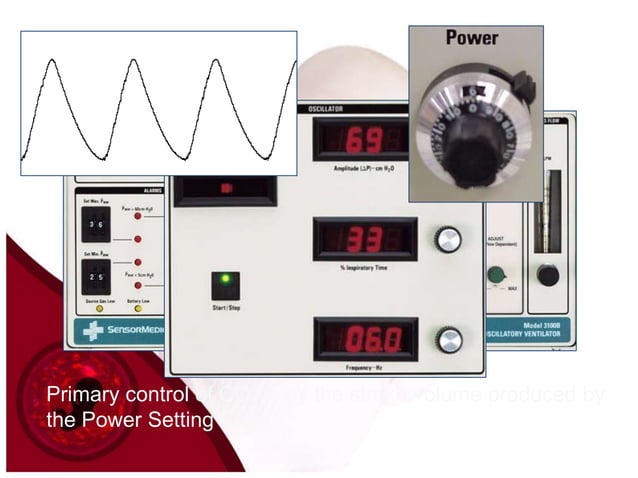 High frequency oscillatory ventilation | PPTX