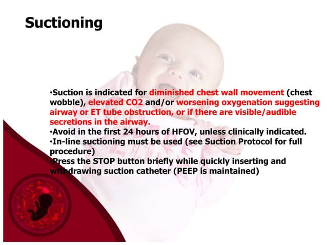 High frequency oscillatory ventilation | PPTX
