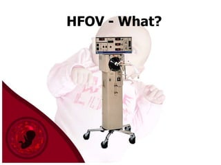 High frequency oscillatory ventilation | PPTX