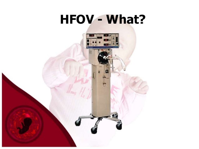 High frequency oscillatory ventilation