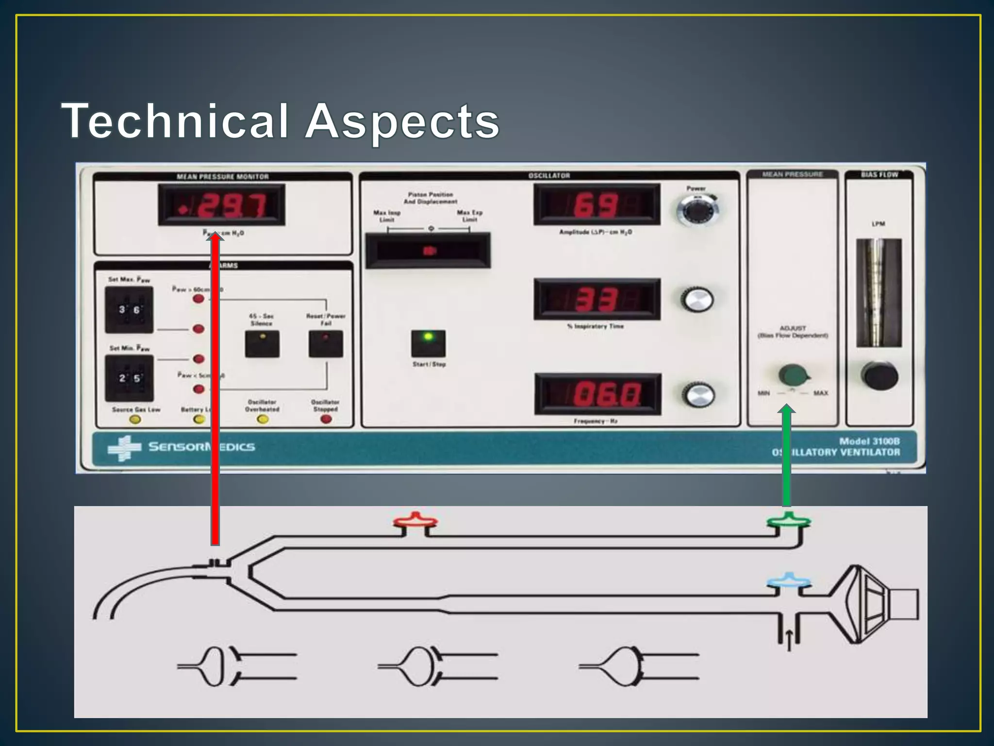 High frequency oscillatory ventilation | PPTX