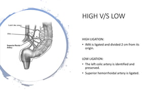 HIGHLOW PRESENTATION | PPT