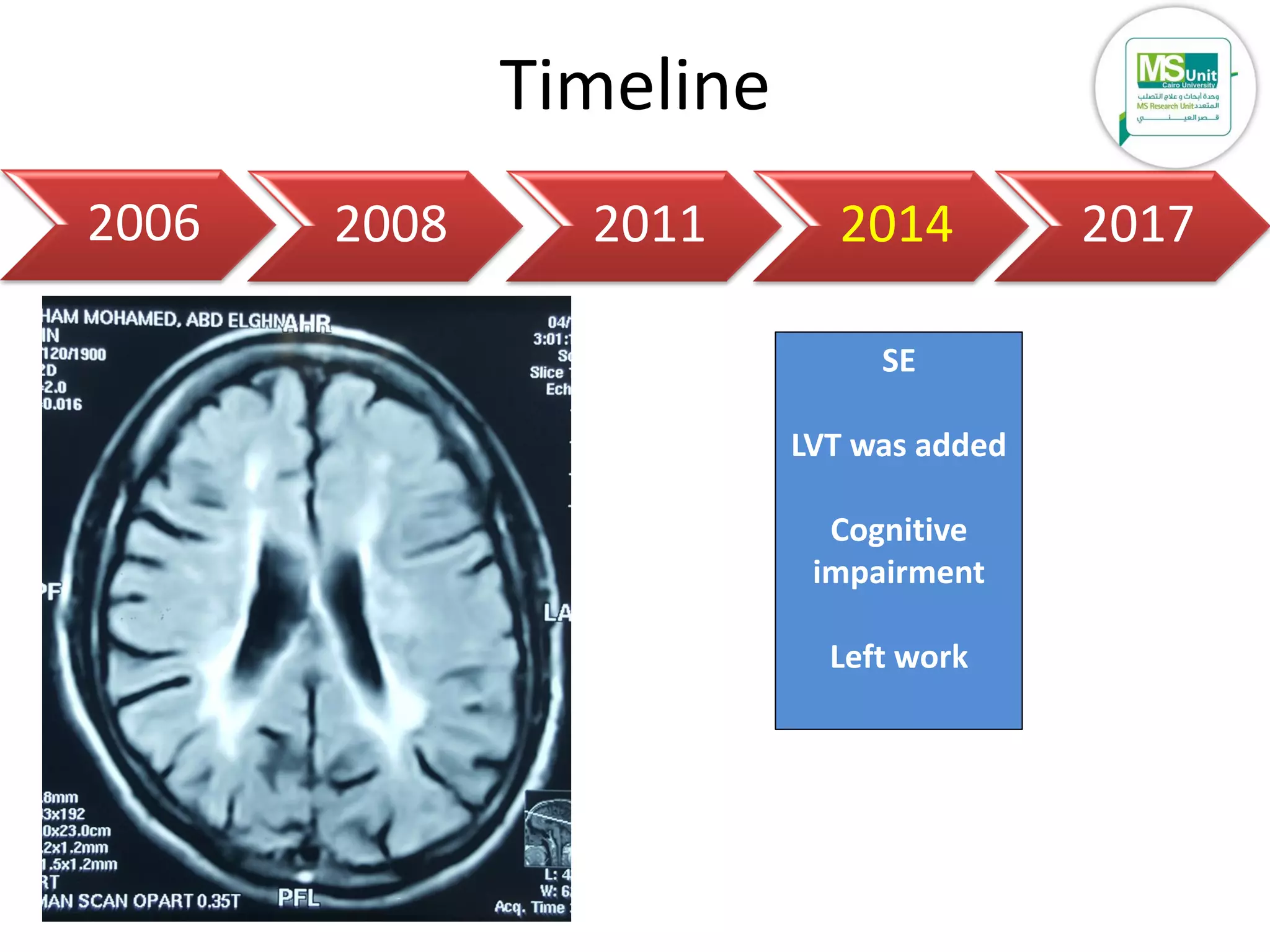 Highly active multiple sclerosis | PPT
