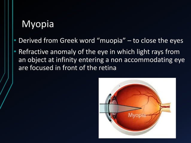 High myopia and management