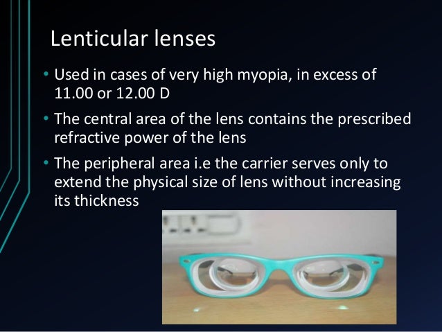 High myopia and management