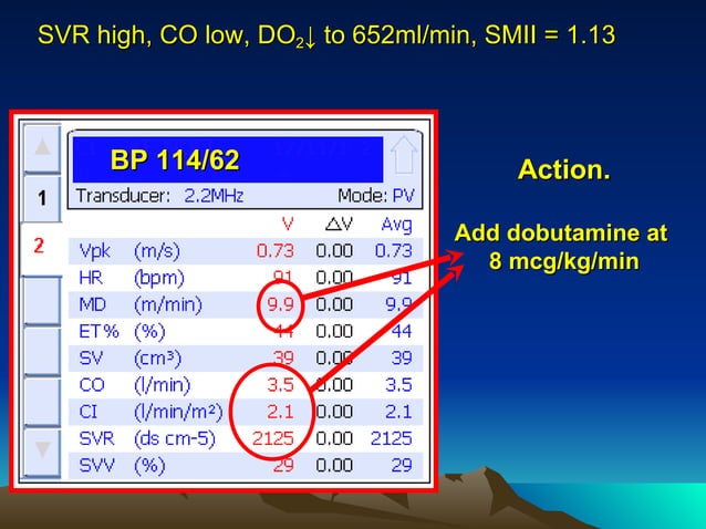High output cardiac failure