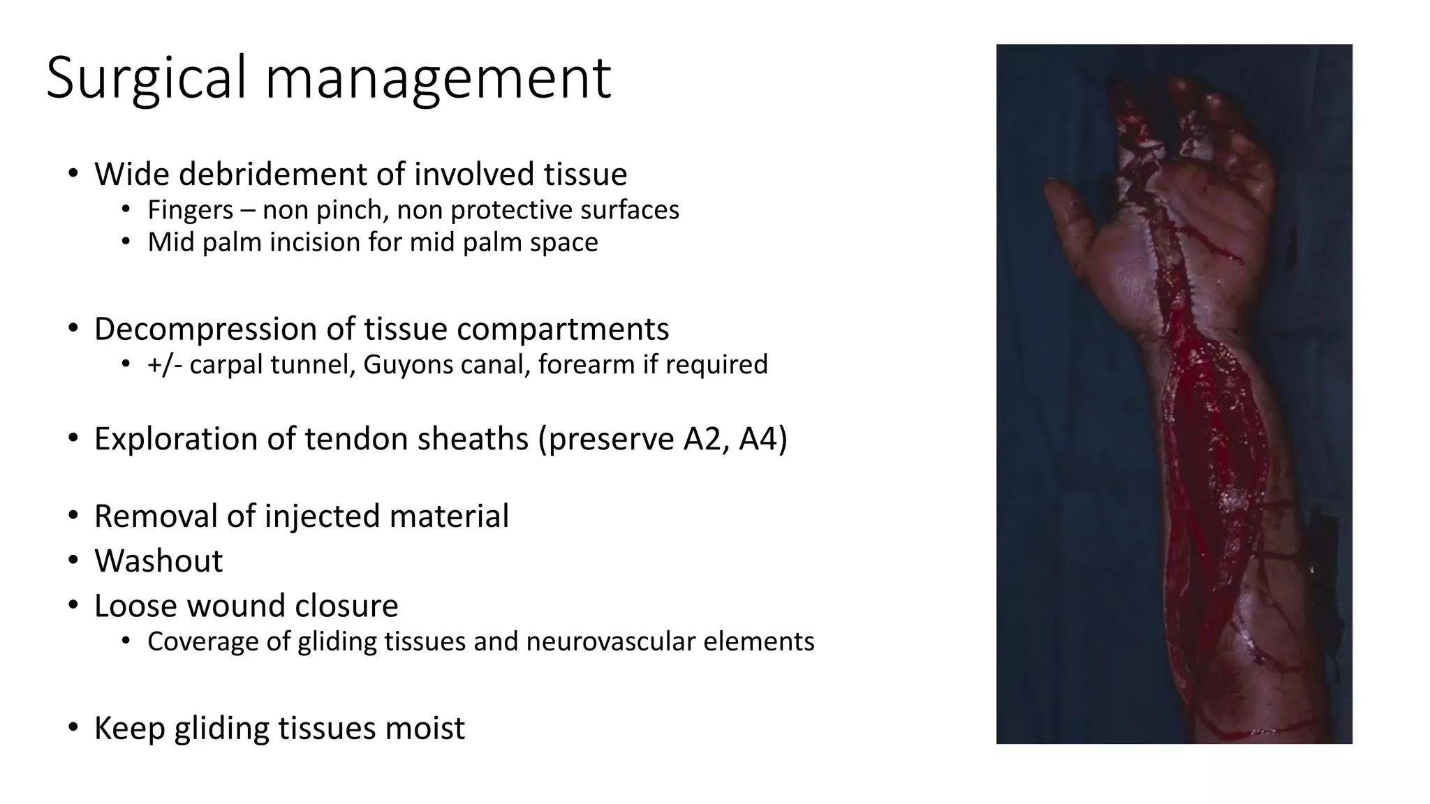 High pressure injection injuries Dr Sean Nicklin | PDF