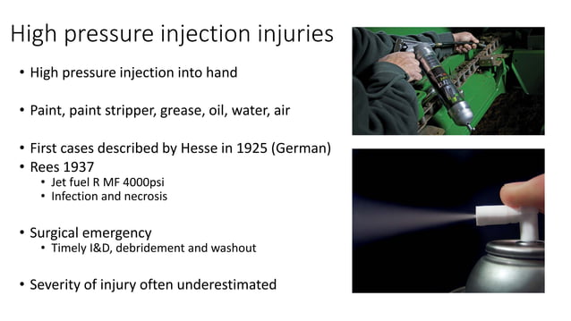 High pressure injection injuries Dr Sean Nicklin | PDF | First Aid ...