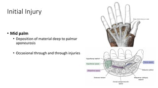 High pressure injection injuries Dr Sean Nicklin | PDF