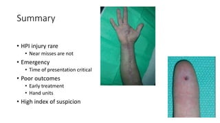 High pressure injection injuries Dr Sean Nicklin