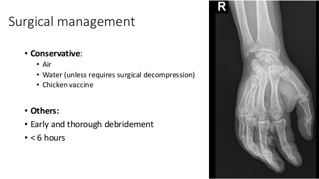 High pressure injection injuries Dr Sean Nicklin