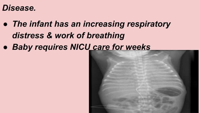 HIGH RISK NEWBORN.pptx