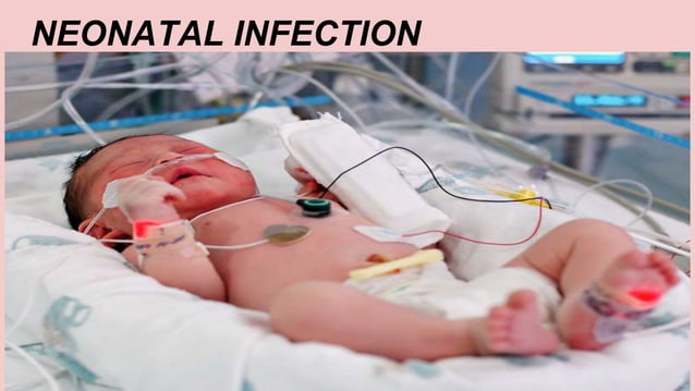 HIGH RISK NEWBORN.pptx