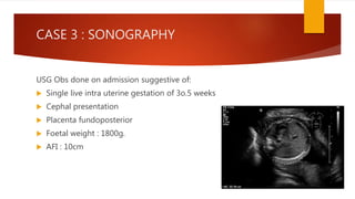 High risk obstetrics | PPTX