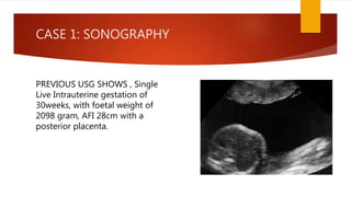 High risk obstetrics | PPTX