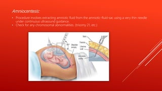 High risk pregnancy-Factors & Diagnostic Tests | PPT