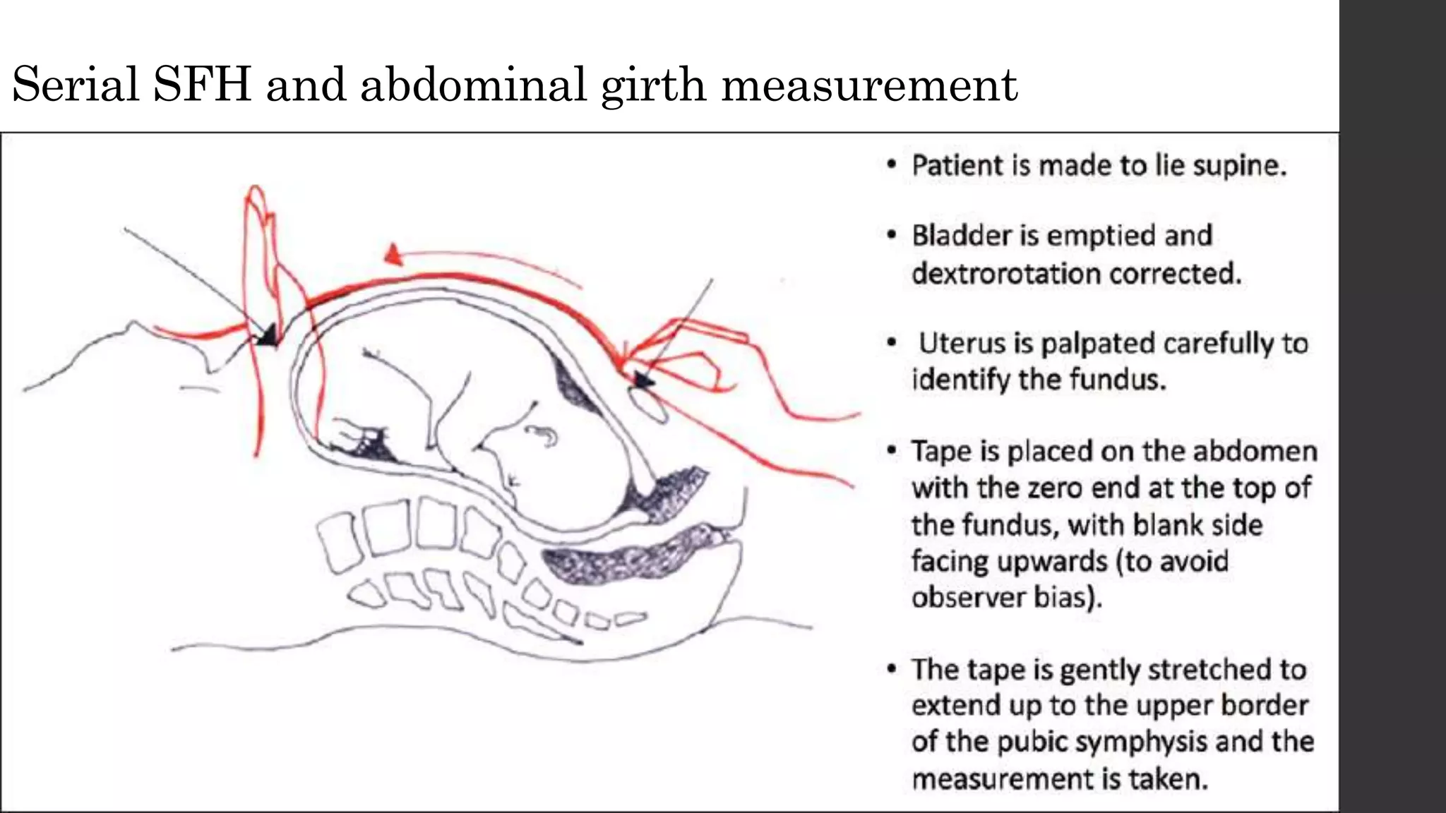High risk pregnancy | PDF