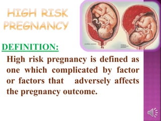 High risk pregnancy | PPTX