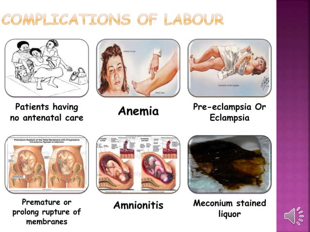 High risk pregnancy | PPTX | Pregnancy | Reproductive Health