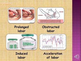 High risk pregnancy | PPTX