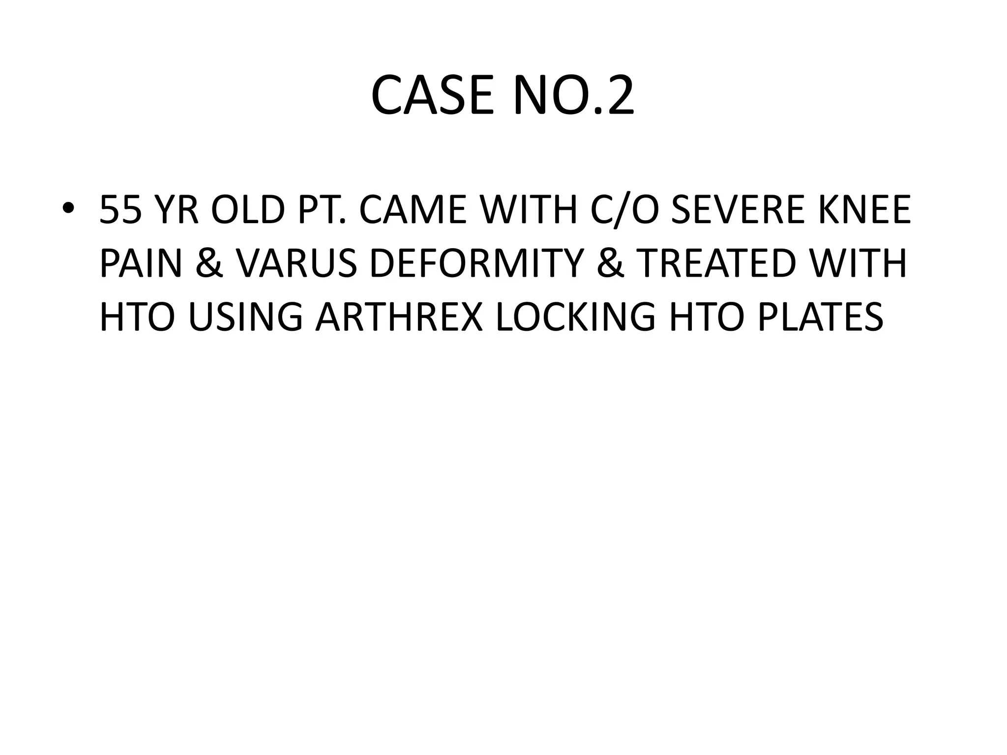 High tibial osteotomy in osteoarthritis knee & genu varum | PPT